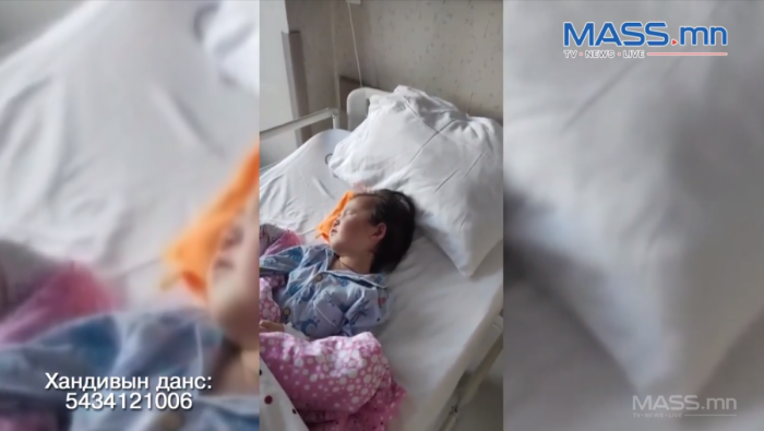 Хойд эцэгтээ зодуулж хүнд гэмтсэн 3 настай хүүгийн ээжийг 300 мянган